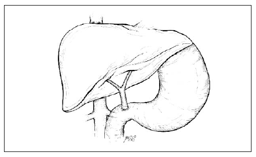 EXPERIMENTAL AND CLINICAL TRANSPLANTATION