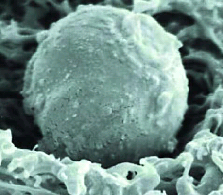 EXPERIMENTAL AND CLINICAL TRANSPLANTATION