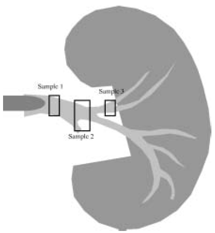 EXPERIMENTAL AND CLINICAL TRANSPLANTATION