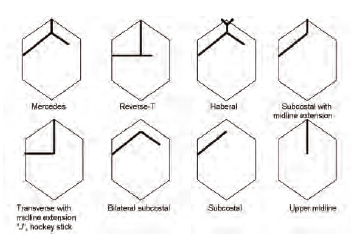 EXPERIMENTAL AND CLINICAL TRANSPLANTATION