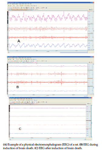 EXPERIMENTAL AND CLINICAL TRANSPLANTATION