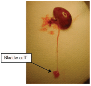 EXPERIMENTAL AND CLINICAL TRANSPLANTATION